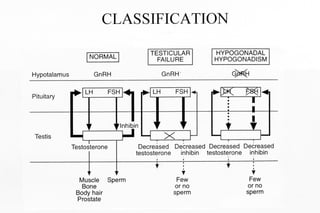 male hypogonadism lecture for uG stu.ppt