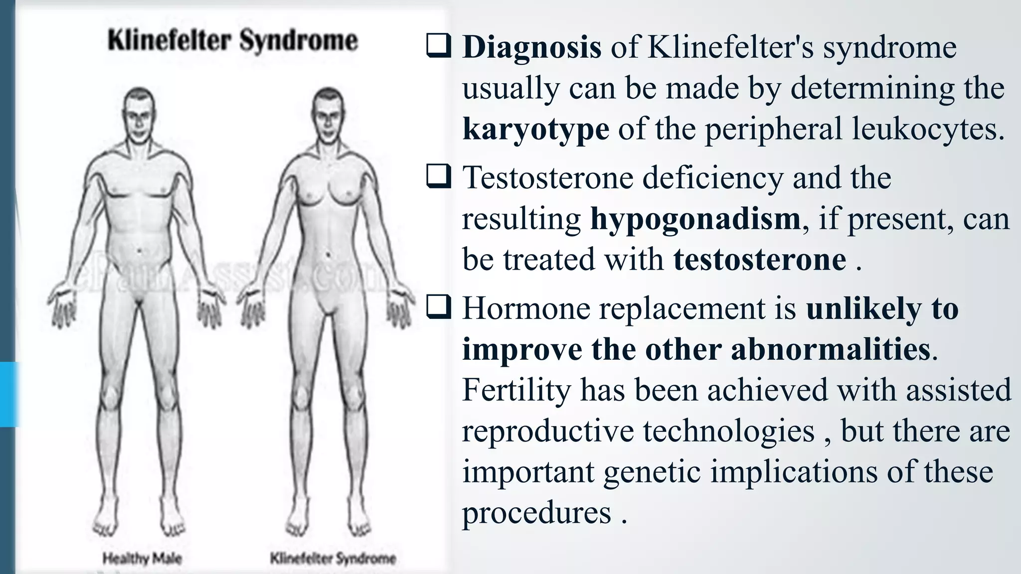 Male Hypogonadism - Rivin | PPTX