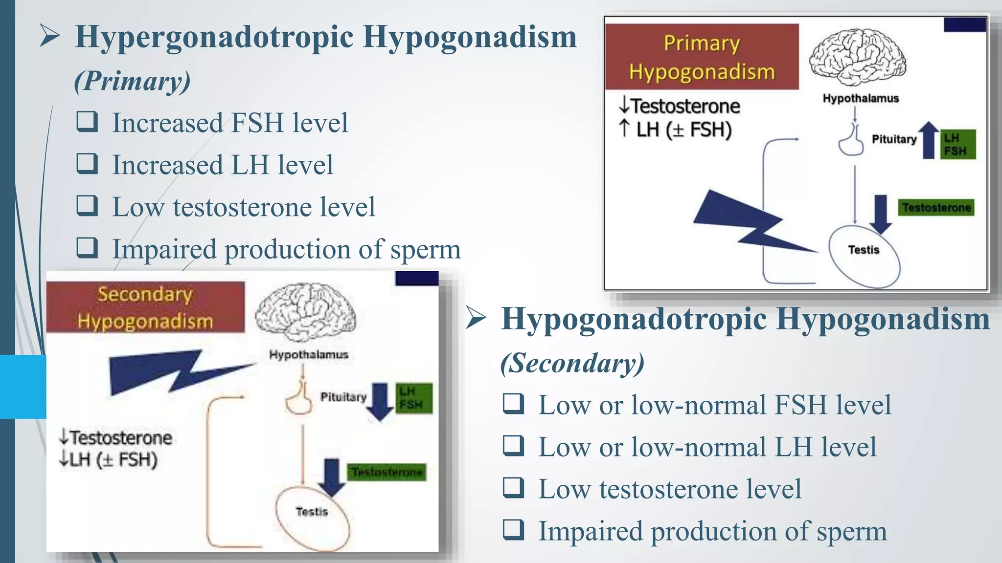 Male Hypogonadism - Rivin | PPTX
