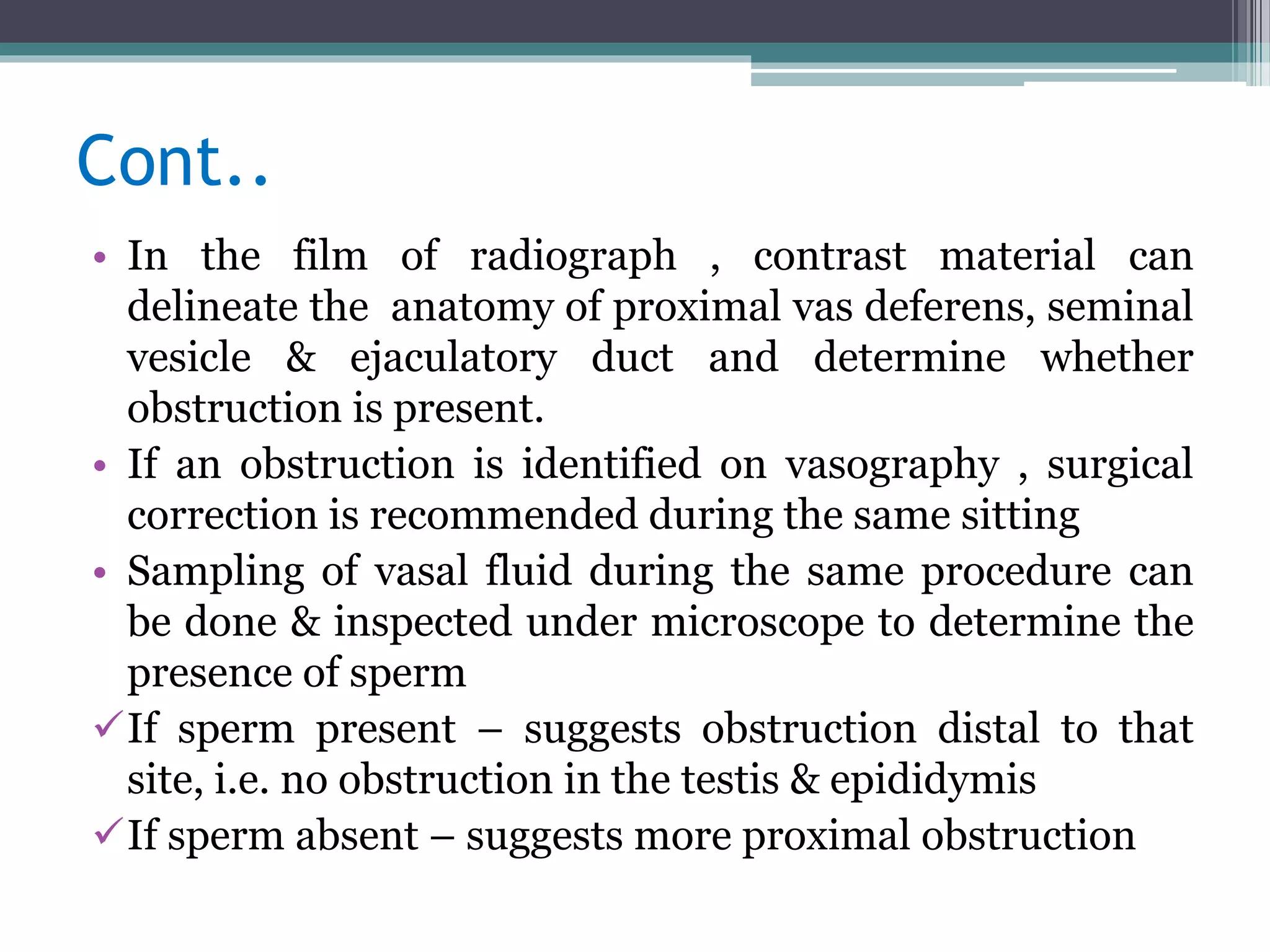 Male infertility | PPTX