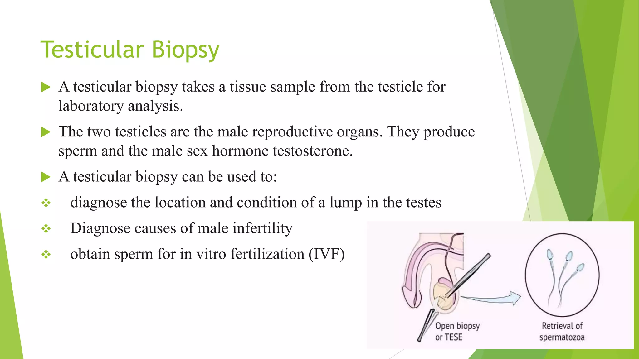 MALE INFERTILITY.pptx