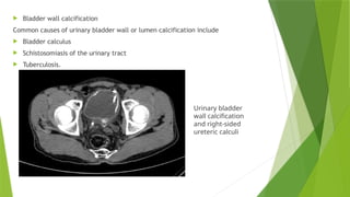 MALE Pelvis power point presentation for master students | PPTX