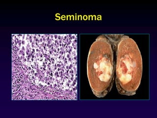 Male Reproductive m3 (2).ppt