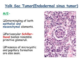 Hydrocele and testicular tumor | PPTX