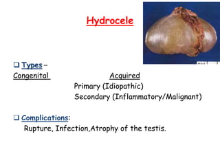 Hydrocele and testicular tumor | PPTX