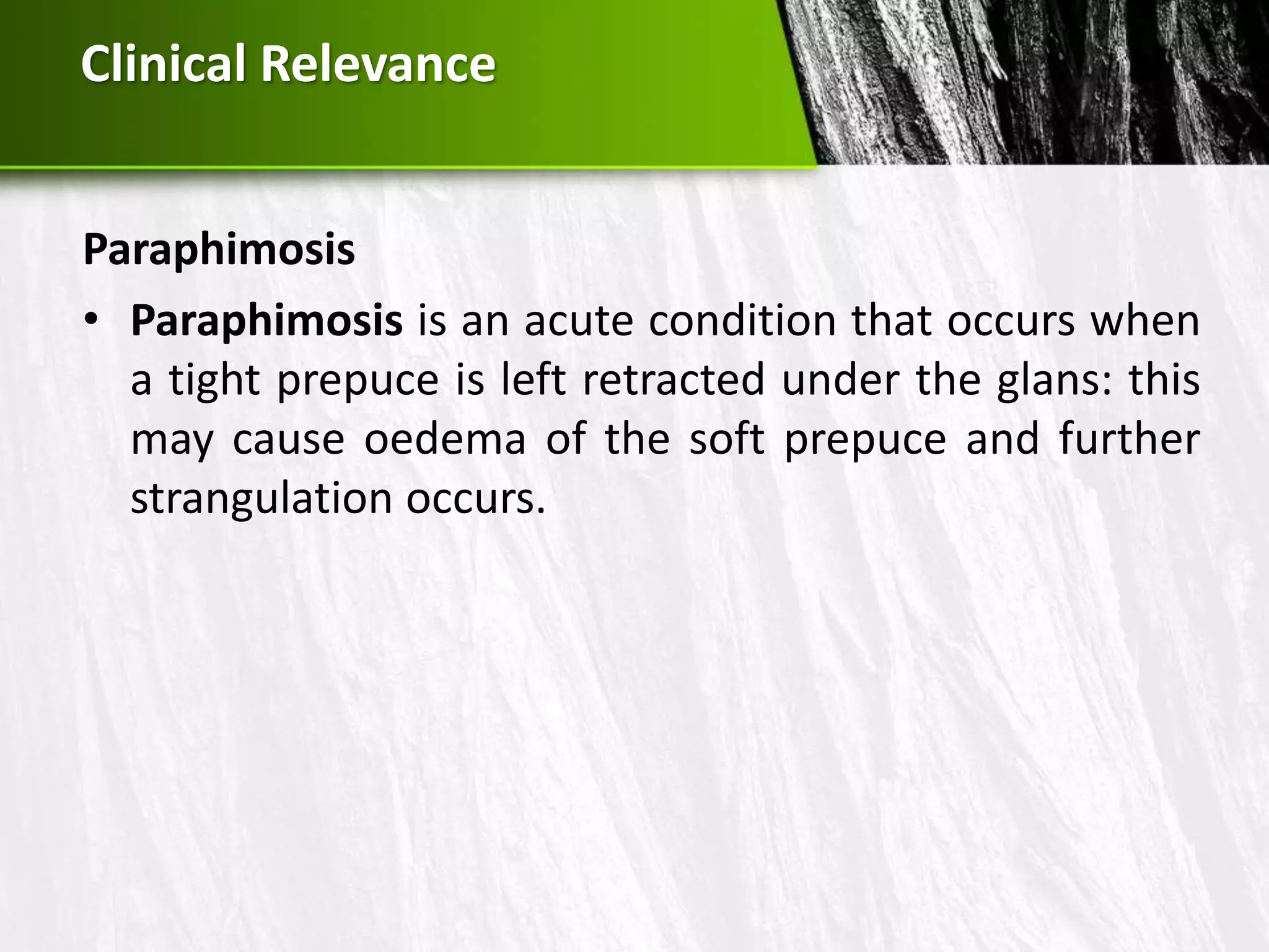 Male reproductive system | PPTX