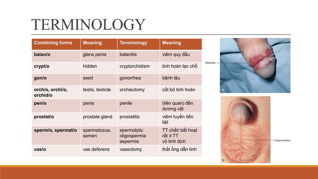 Male Reproductive System English Terminology | PPTX