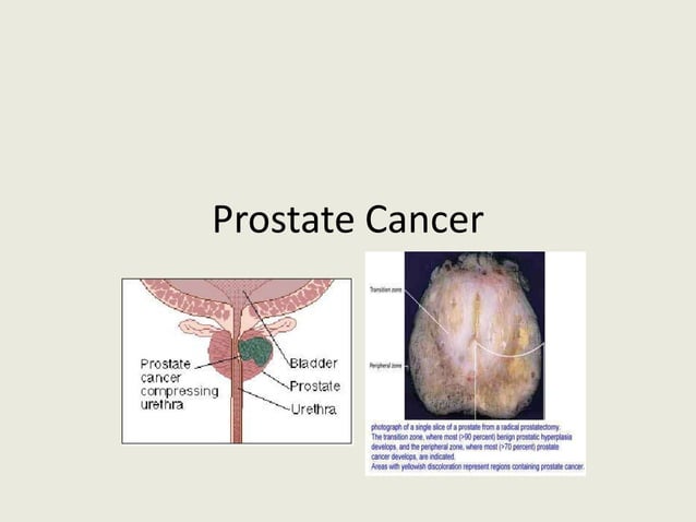 Male reproductive system disorders and diseases | PPTX