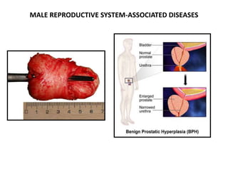 Male Reproductive System - Anatomy, Physiology and Pathology | PPTX