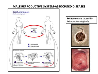 Male Reproductive System - Anatomy, Physiology and Pathology | PPTX