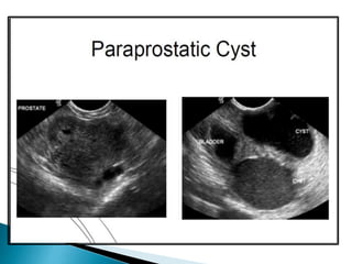 sonography of male and female genital system in Dog | PPTX