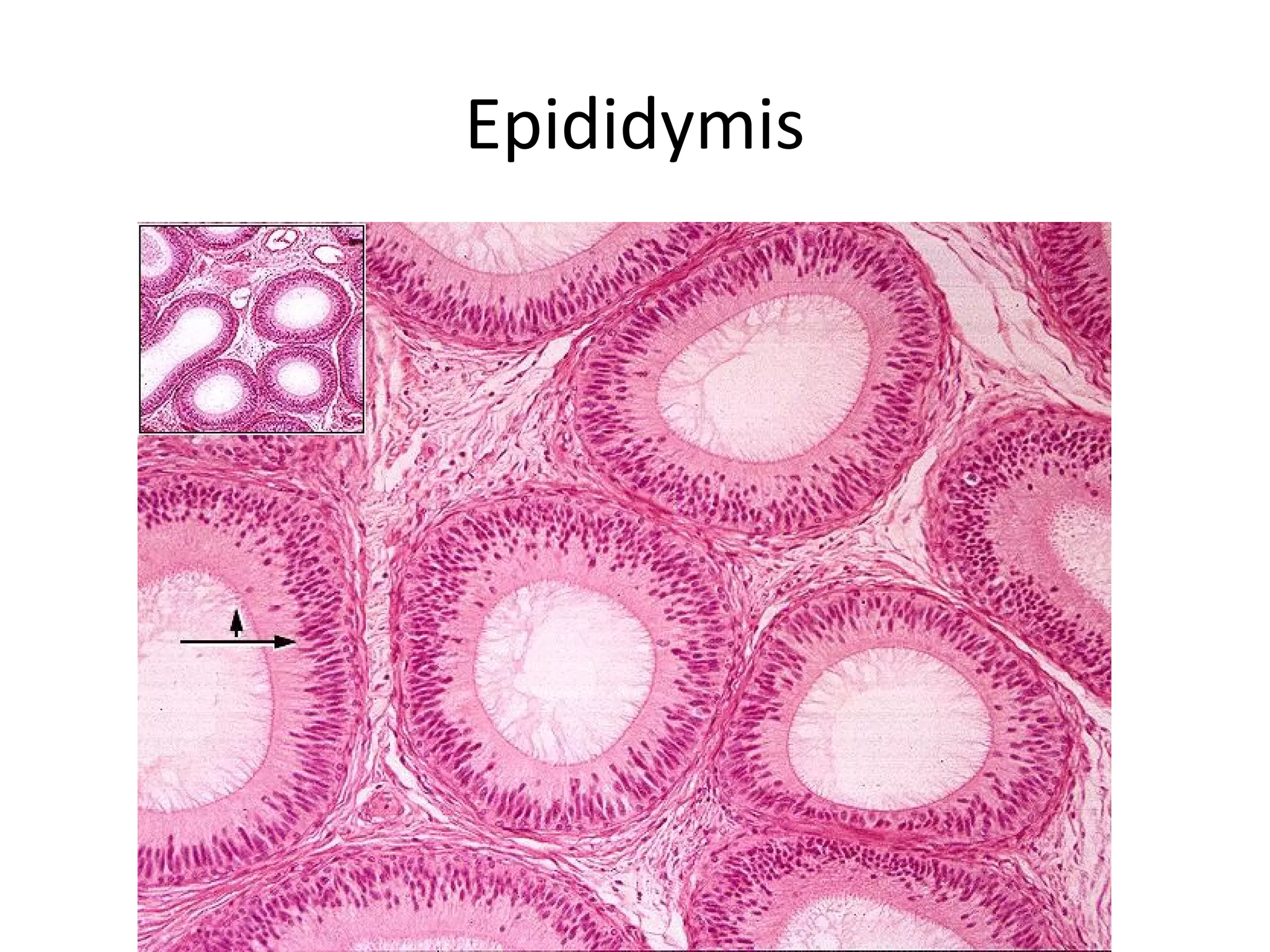 Male repro epididymis vas seminal vescile | PPT