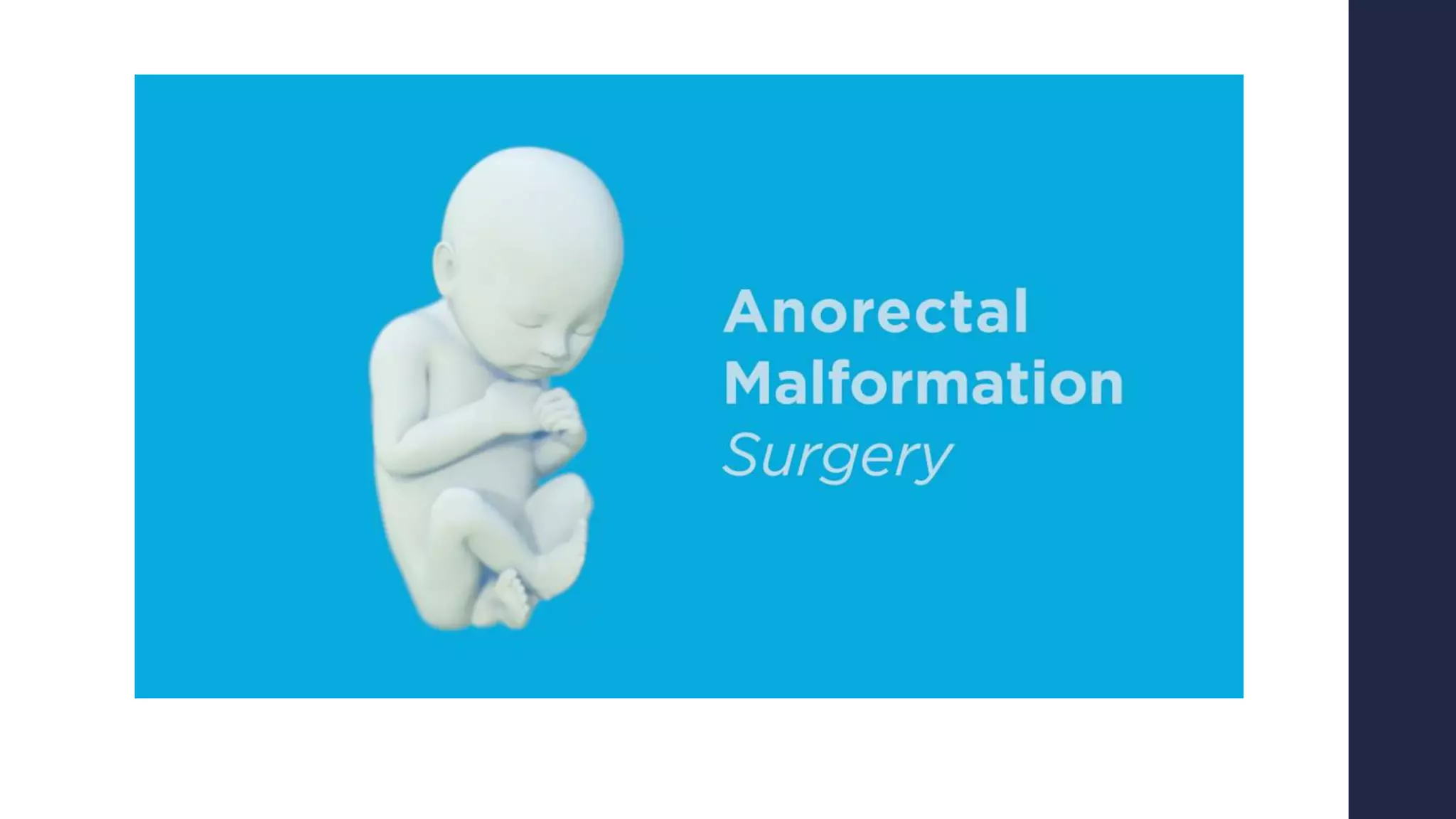 Malformación anorrectal | PPTX