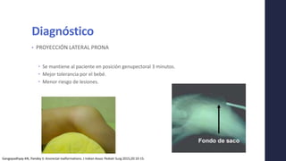 Malformación anorrectal | PPT