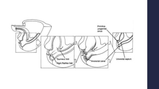 Malformación anorrectal | PPTX