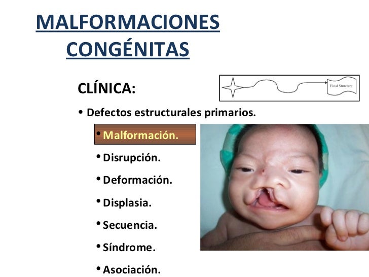 Malformaciones