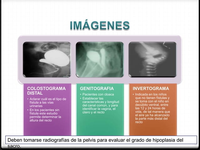 Malformaciones anorectales | PPT