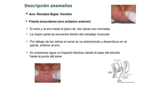 Malformaciones anorrectales EN PEDIATRIA HD.pptx