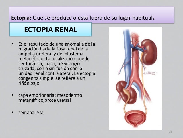 Malformaciones Embriologia
