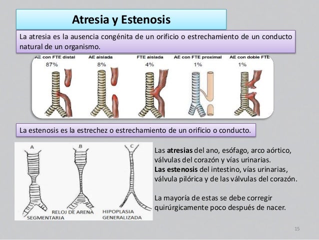 Malformaciones Embriologia