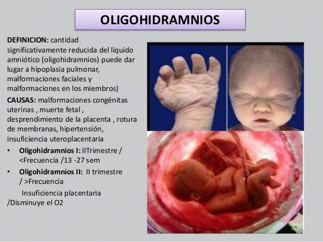 Malformaciones Embriologia
