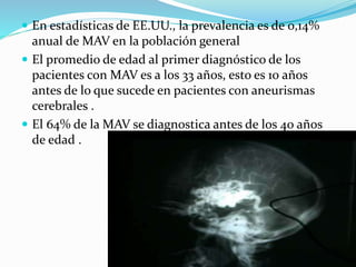 Malformaciones Arteriovenosas.pptx