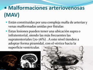 Malformaciones Arteriovenosas.pptx
