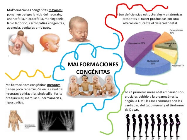 Malformaciones congenitas