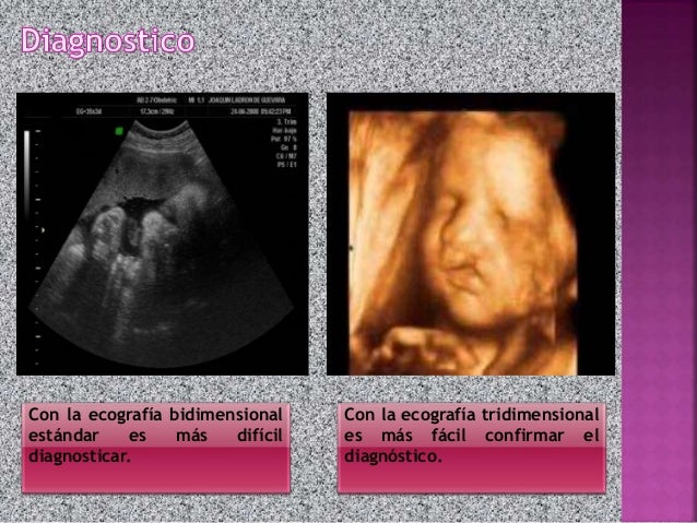 Malformaciones congenitas
