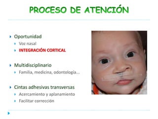 Labio y paladar hendido | PPTX