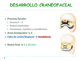 Labio y paladar hendido | PPTX