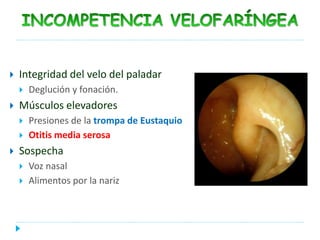 Labio y paladar hendido | PPTX