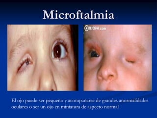 Malformaciones congenitas | PPTX