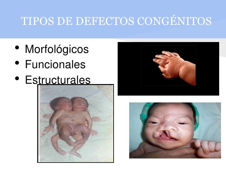 Malformaciones congénitas
