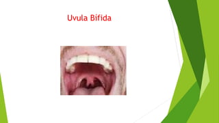 Malformaciones congénitas- Cabeza y cuello.pptx