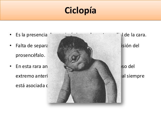 Malformaciones congénitas del ojo