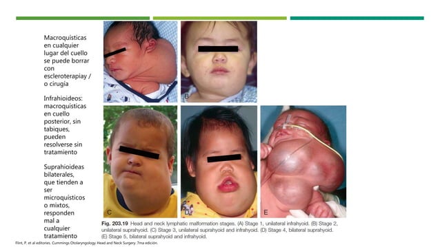 Malformaciones congénitas en cuello