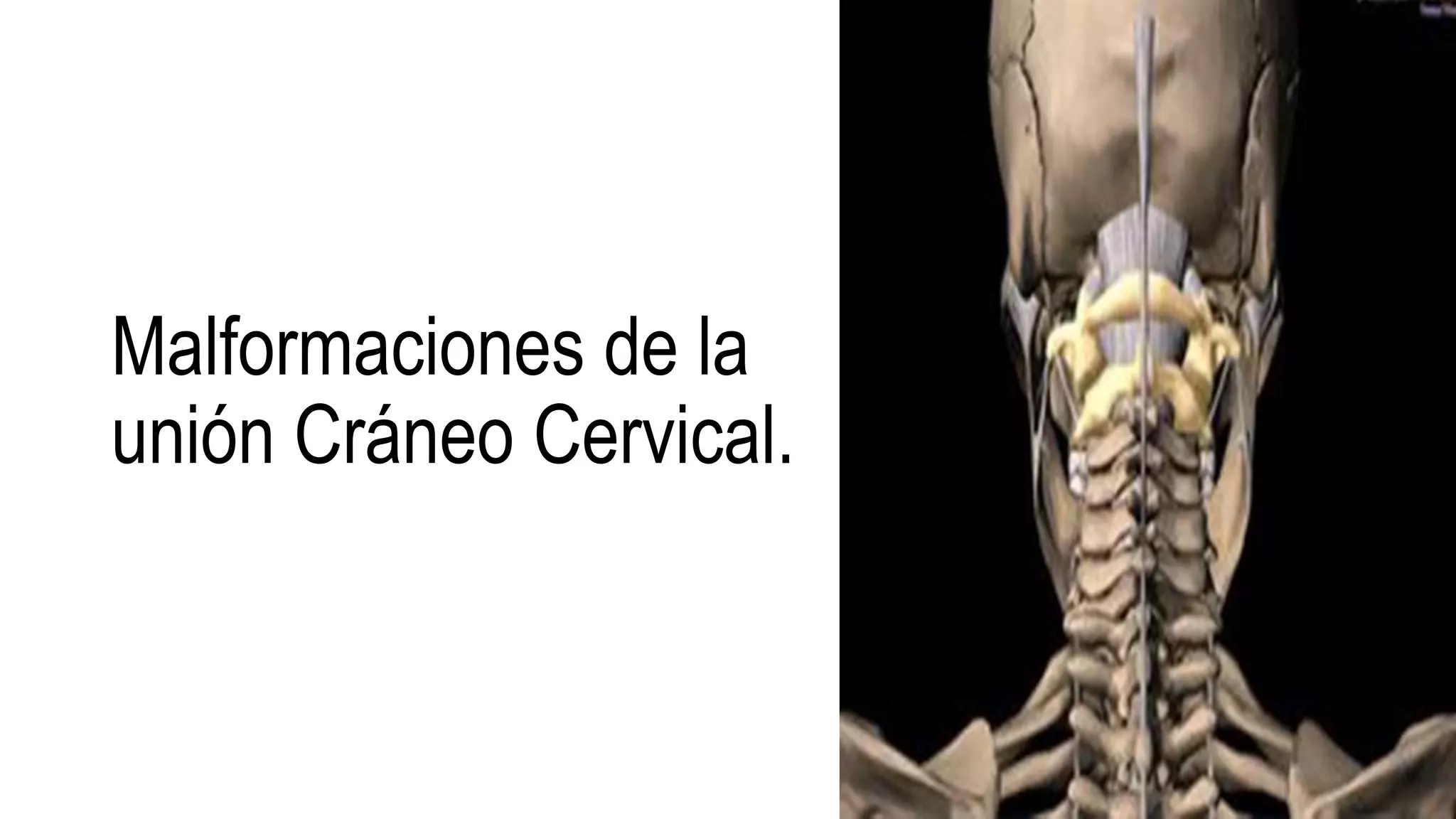 Malformaciones de la union craneocervical | PPTX
