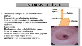 MALFORMACIONES DEL ESÓFAGO.pptx
