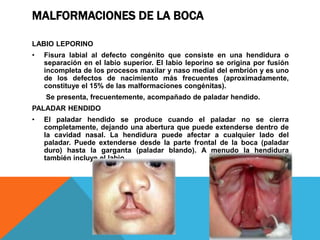 Malformaciones del tubo digestivo pedia | PPTX