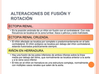 Malformaciones renales | PPTX