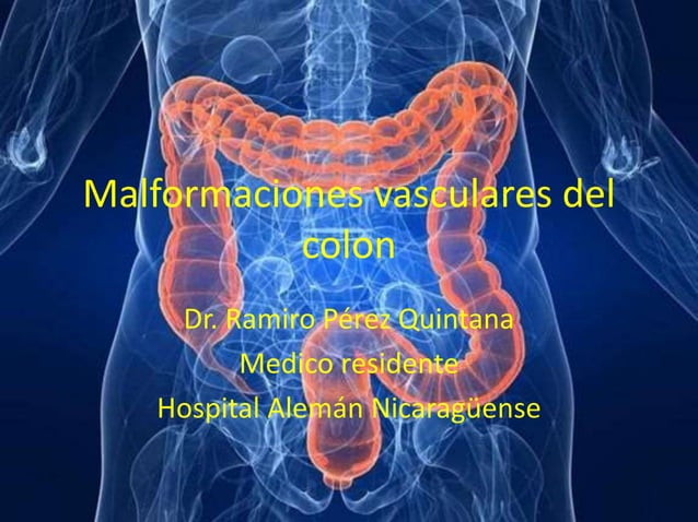 Malformaciones vasculares del colon | PPTX