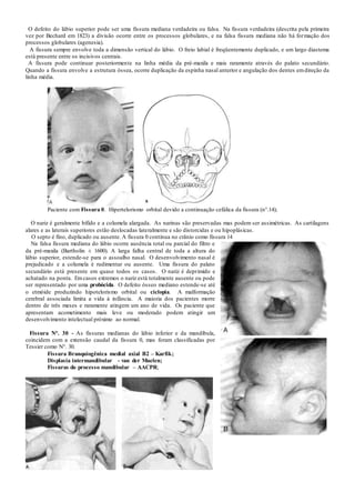 Malformações Craniofaciais | DOC