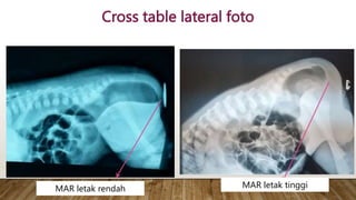 malformasi anorectal bedah anak.pptx