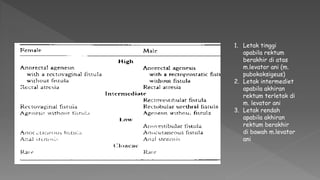 MALFORMASI ANOREKTAL.pptx
