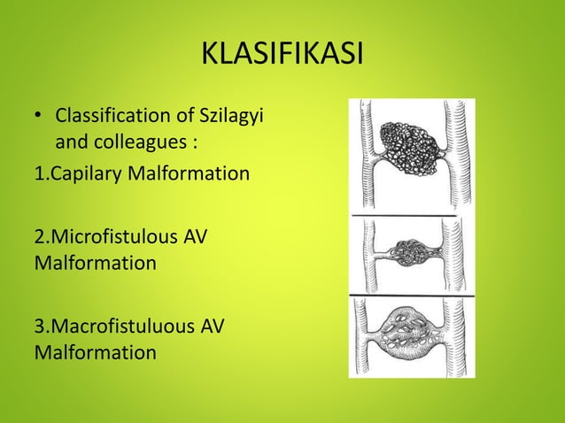 Malformasi vaskular | PPTX