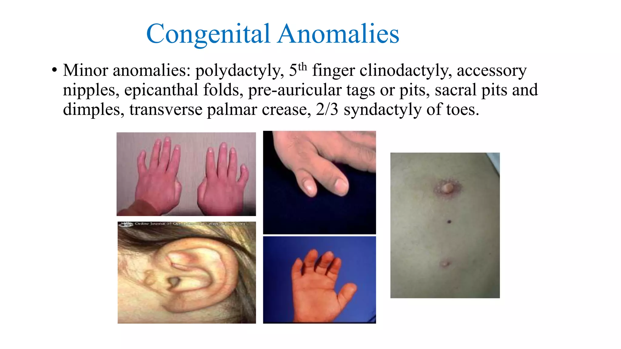 Malformations | PPTX