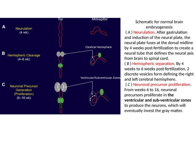 Malformations of Cortical Development.pptx