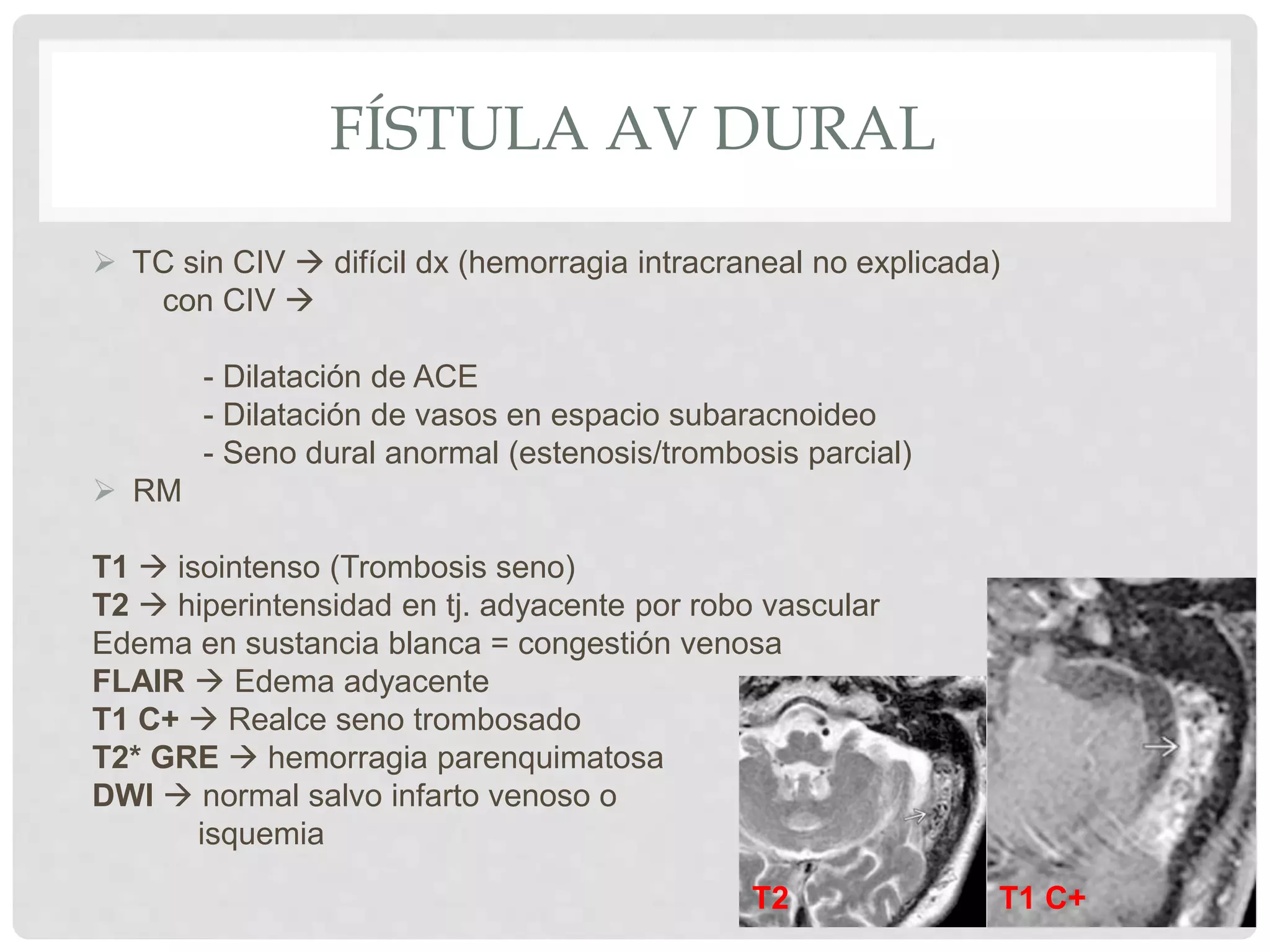 Malformaciones vasculares cerebrales | PPTX