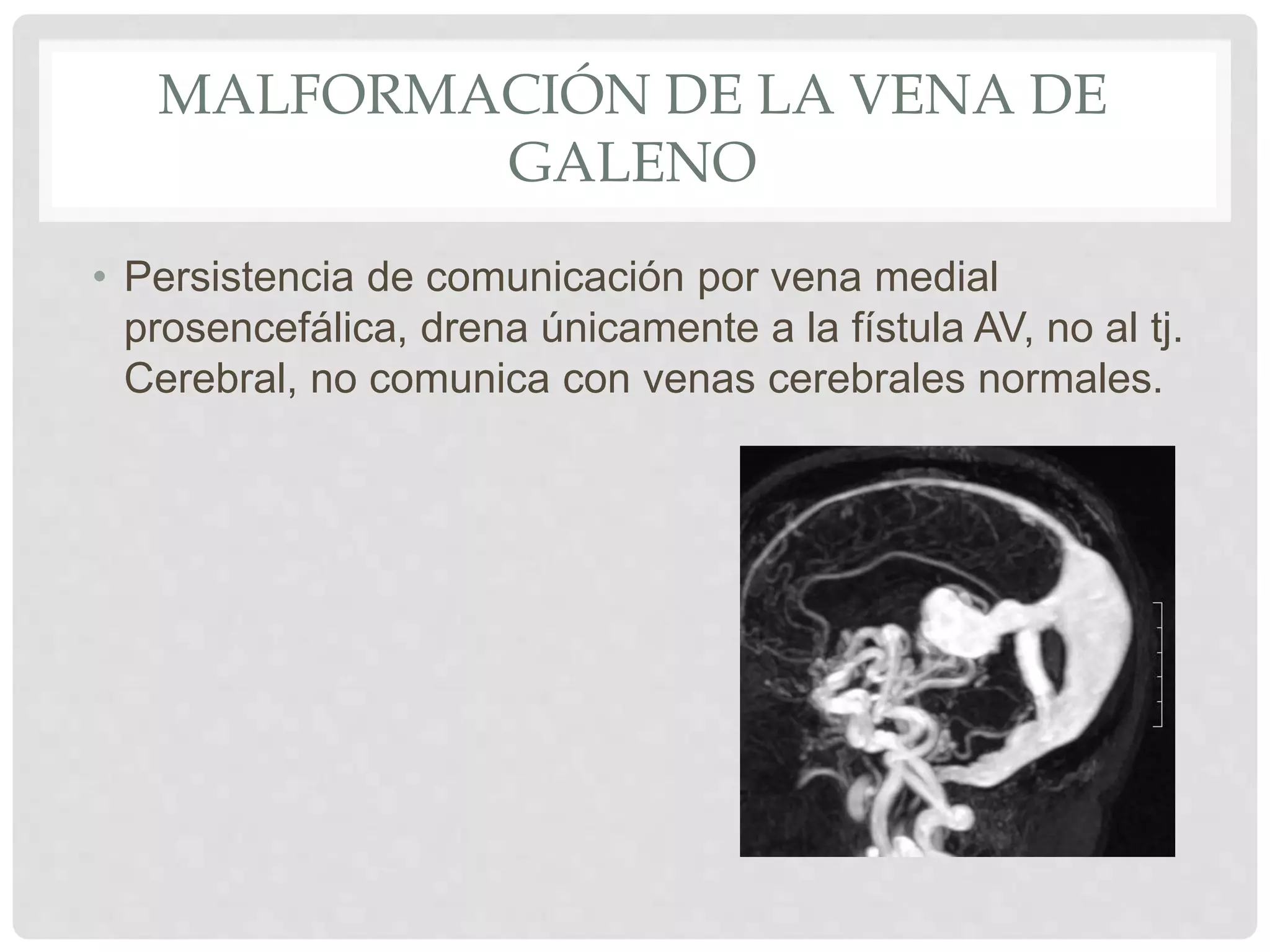 Malformaciones vasculares cerebrales | PPTX